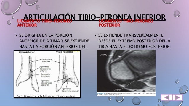 Articulacion tibioperonea
