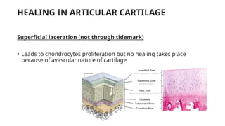 Anatomy of joint Articular cartilage.PPTX