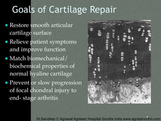 Orthobiologics Of Articular cartilage:Repair to Regenerate to Replace ...
