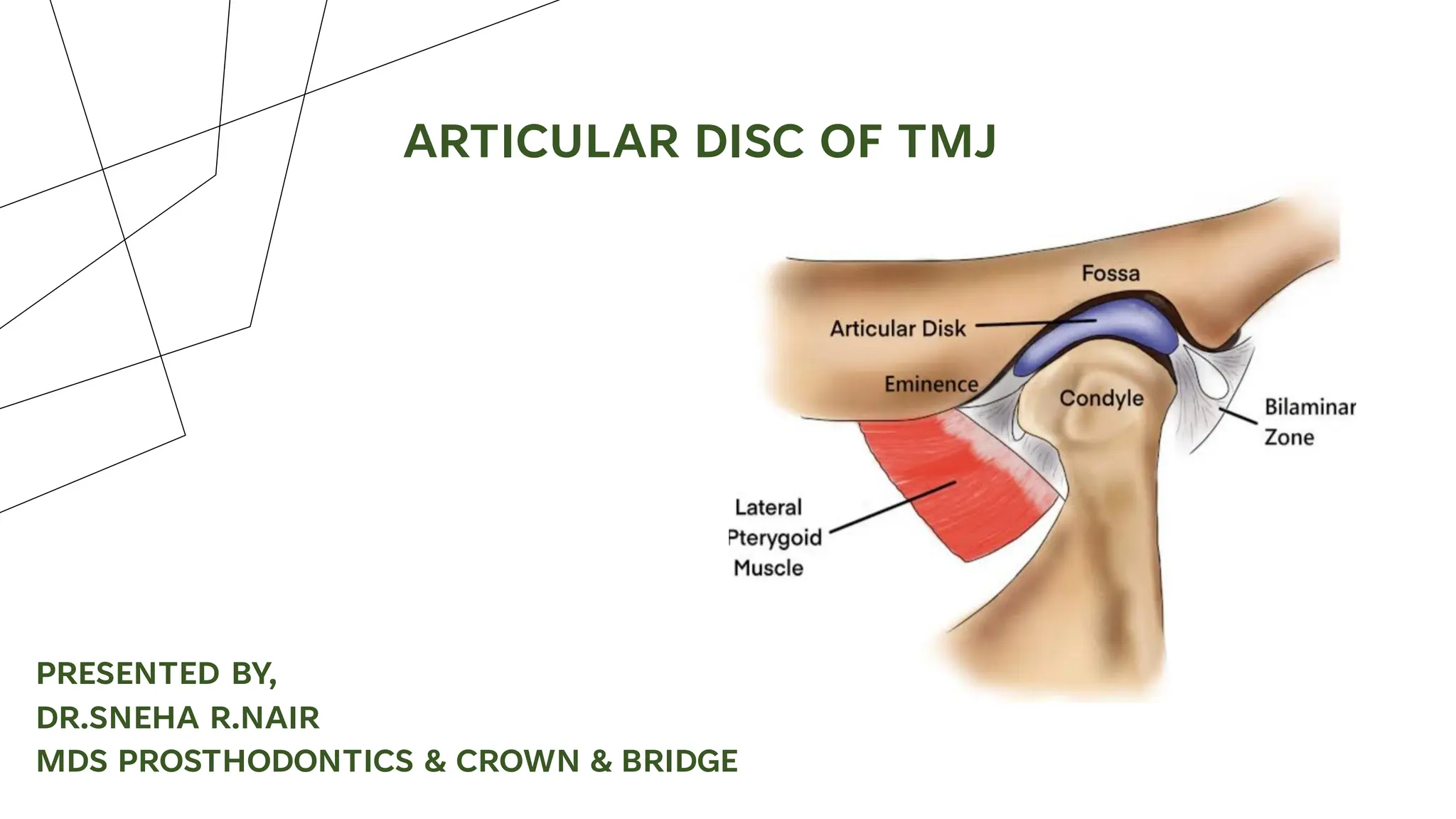ARTICULAR DISC OF TEMPOROMANDIBULAR JOINT | PDF