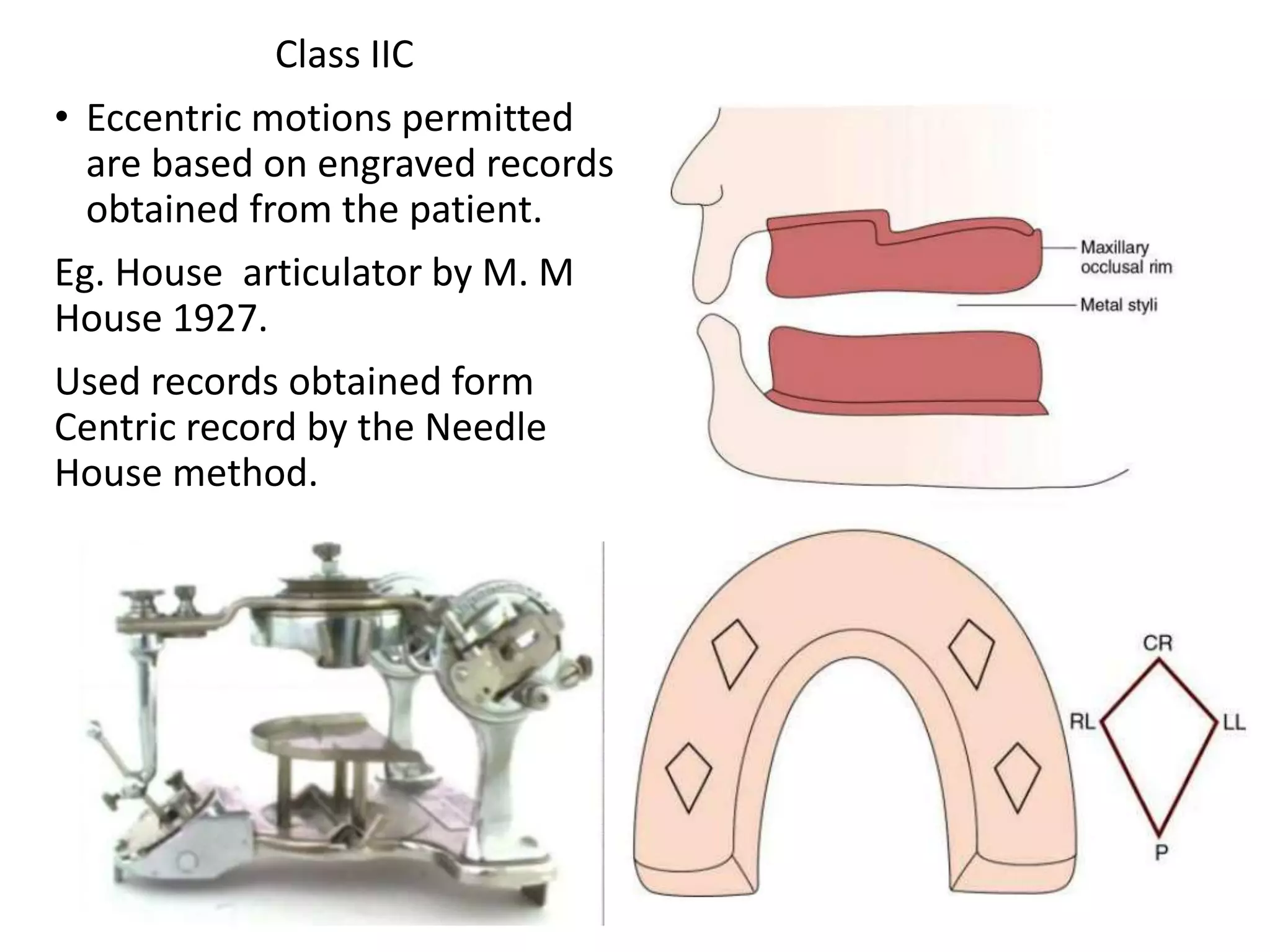 Articulators in Prosthodontics | PPTX
