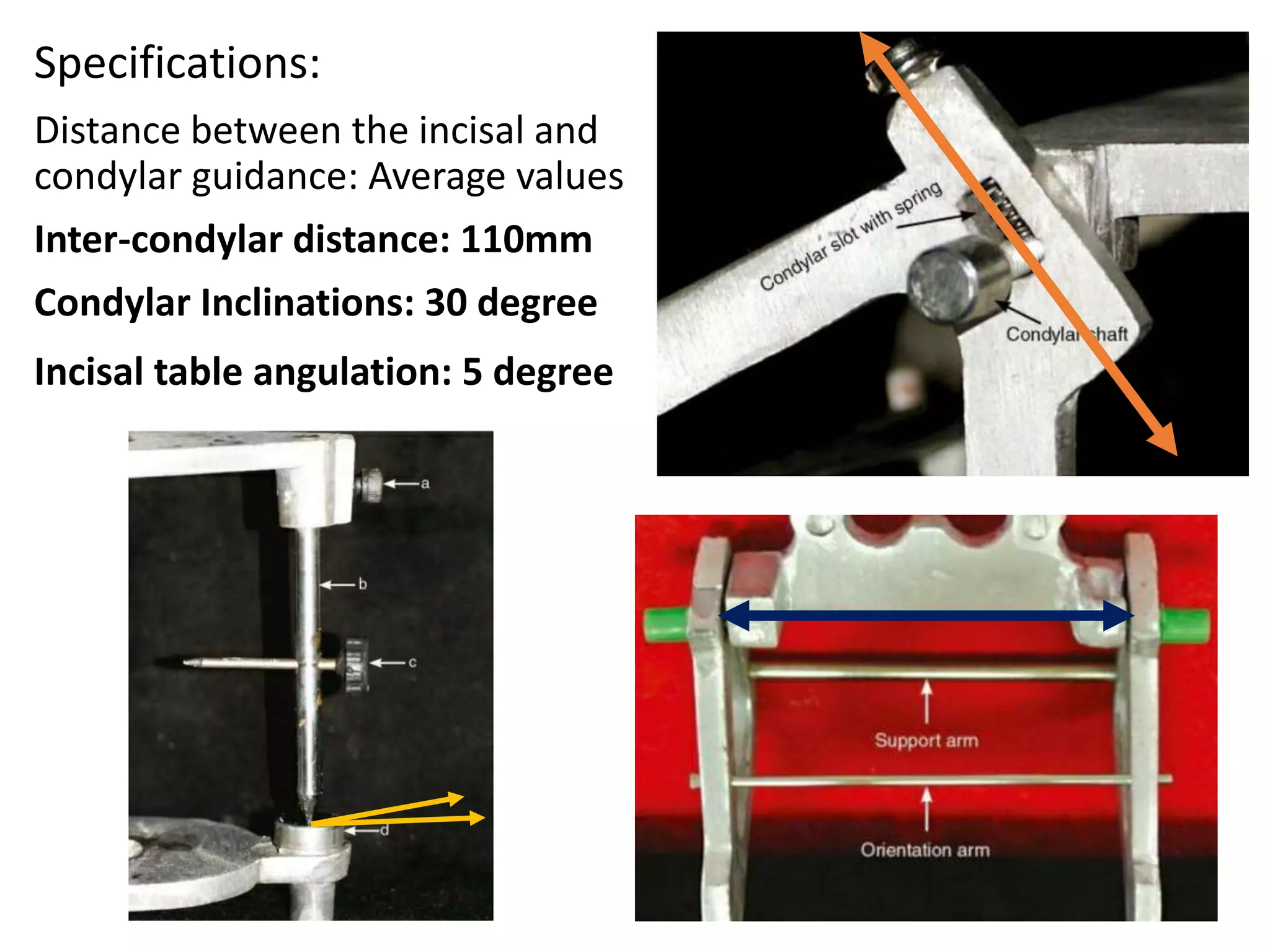 Articulators in Prosthodontics | PPTX