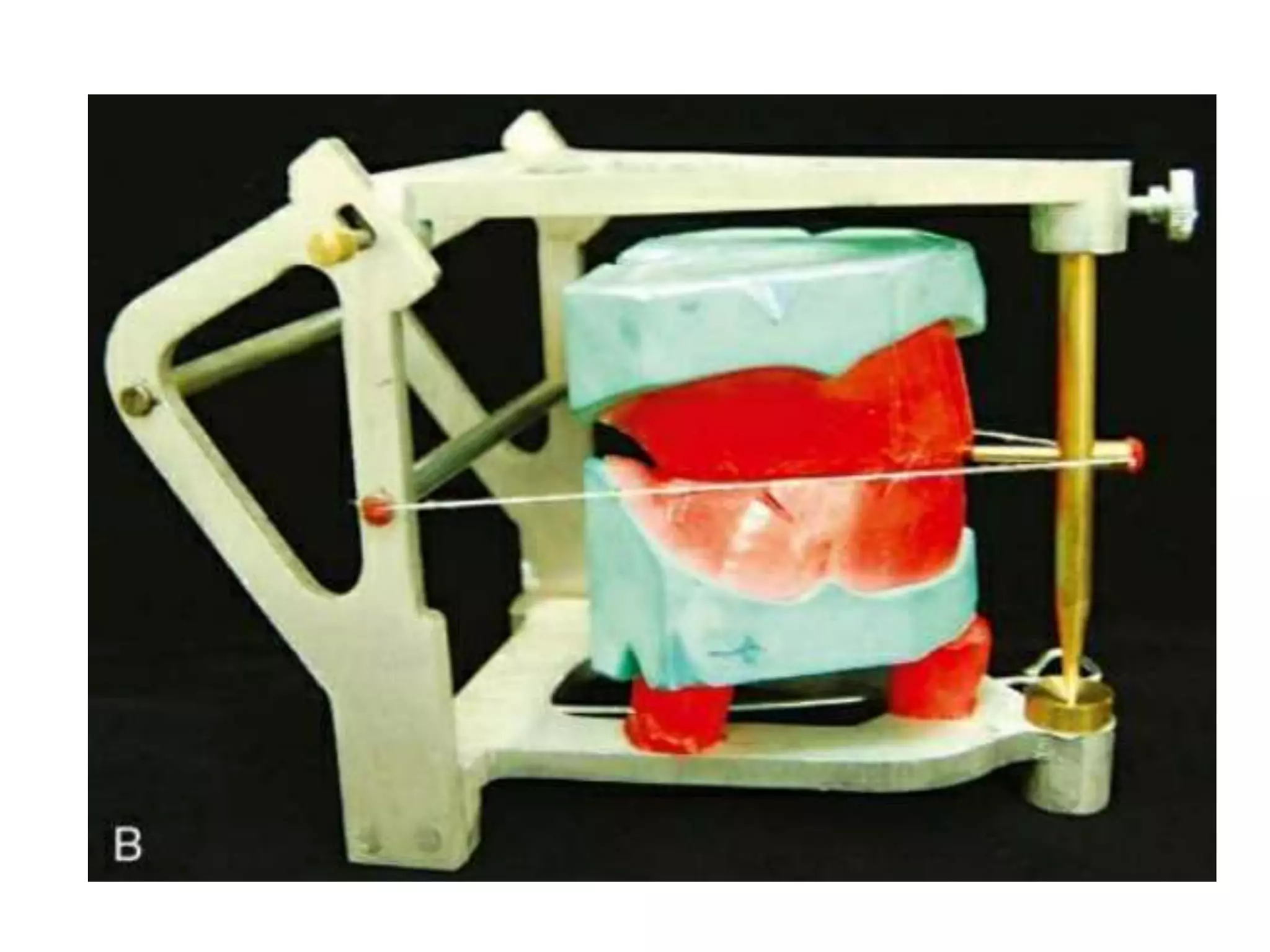 Articulators in Prosthodontics | PPTX