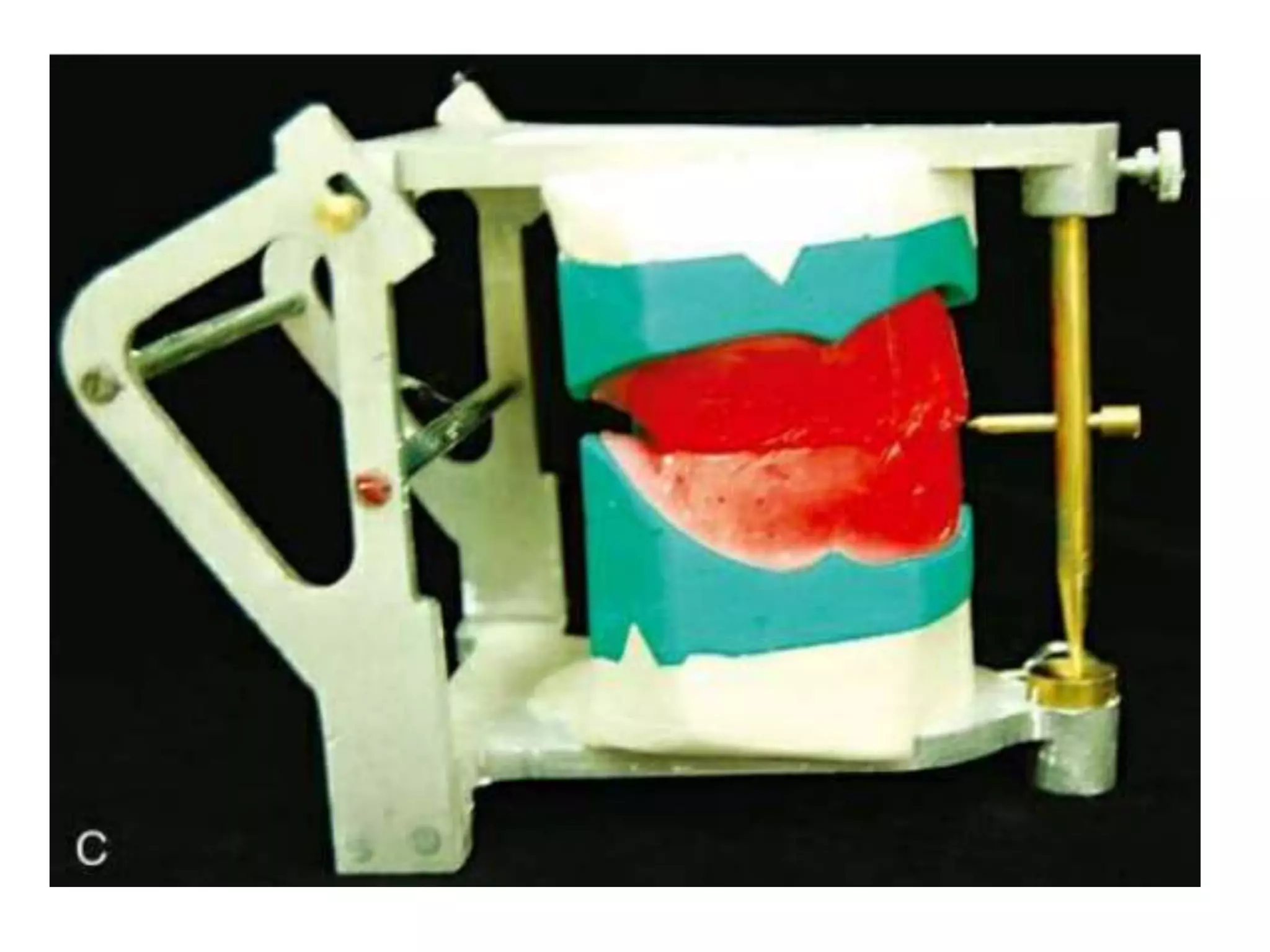 Articulators in Prosthodontics | PPTX