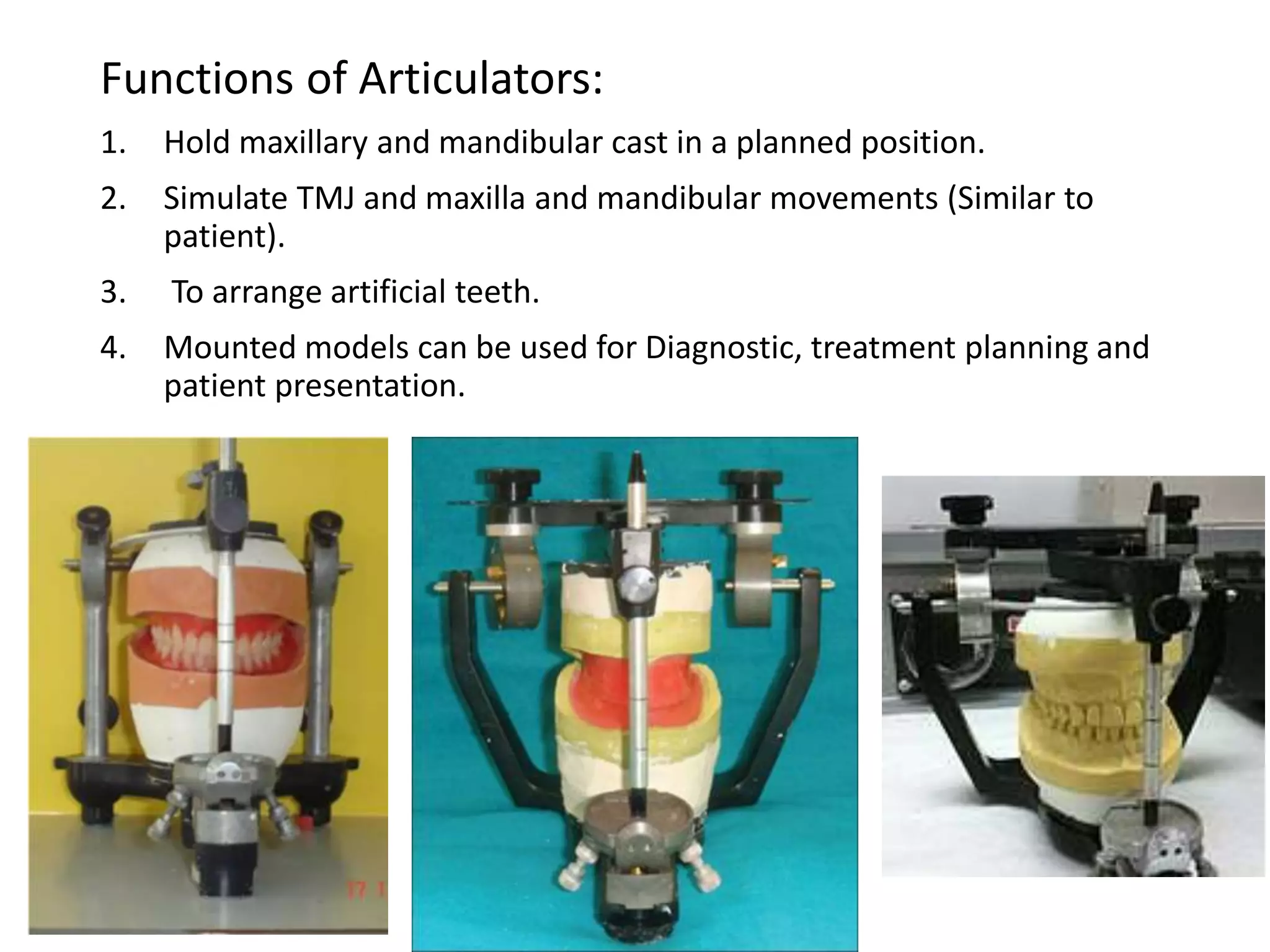 Articulators in Prosthodontics | PPTX