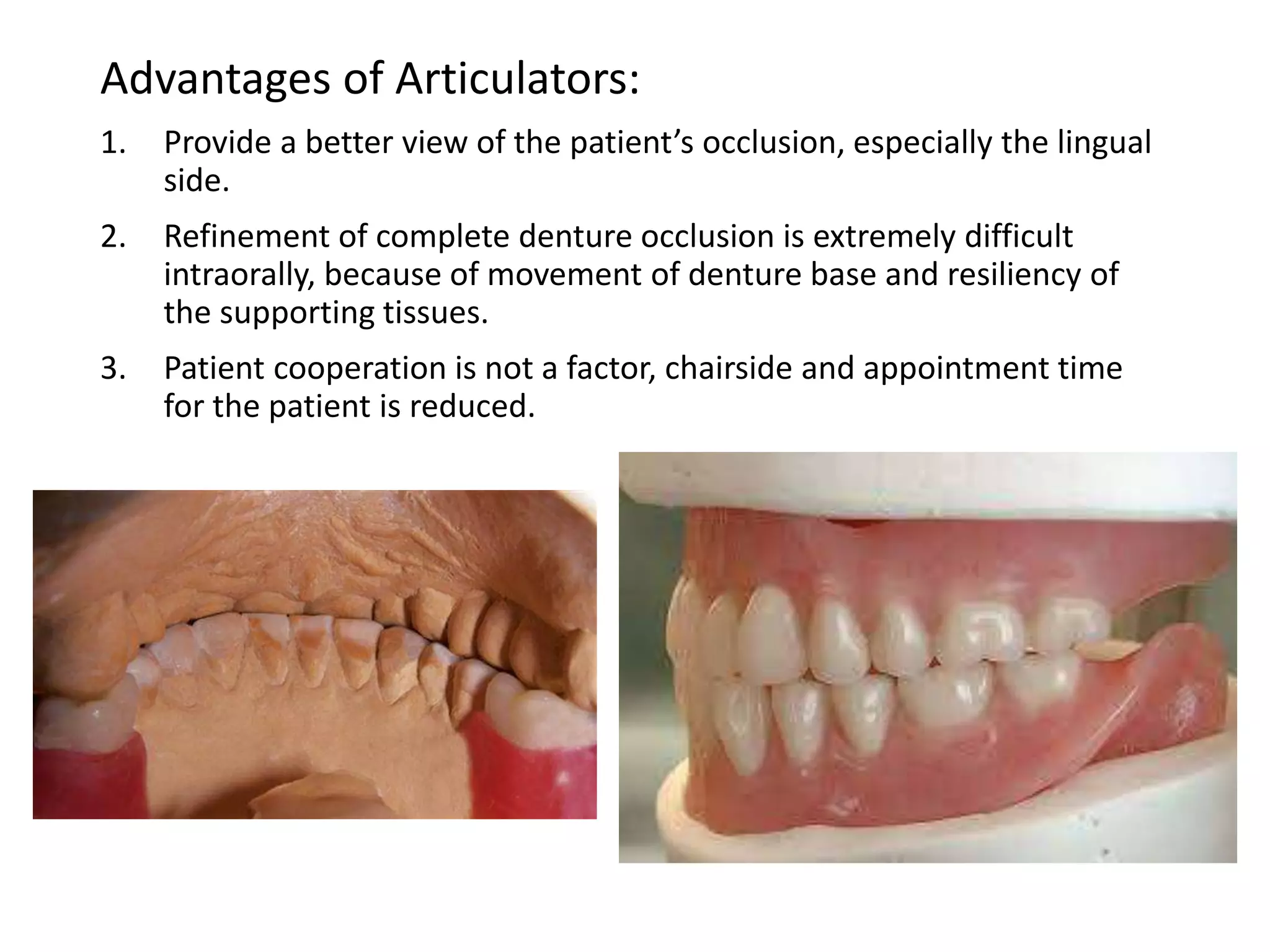 Articulators in Prosthodontics | PPTX