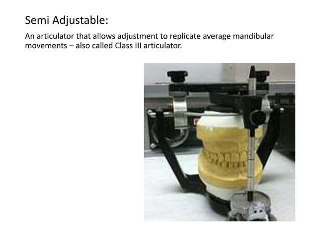 Articulators in Prosthodontics | PPTX | Dental Health | Diseases and ...