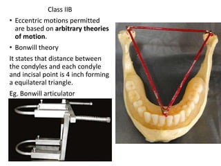 Articulators in Prosthodontics | PPTX