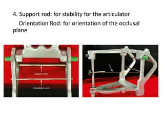 Articulators in Prosthodontics | PPTX
