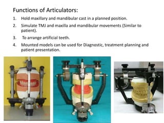 Articulators in Prosthodontics | PPTX