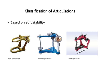 Articulators in Prosthodontics | PPTX