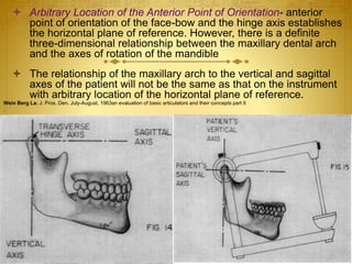 Articulators in fixed partial denture | PPTX