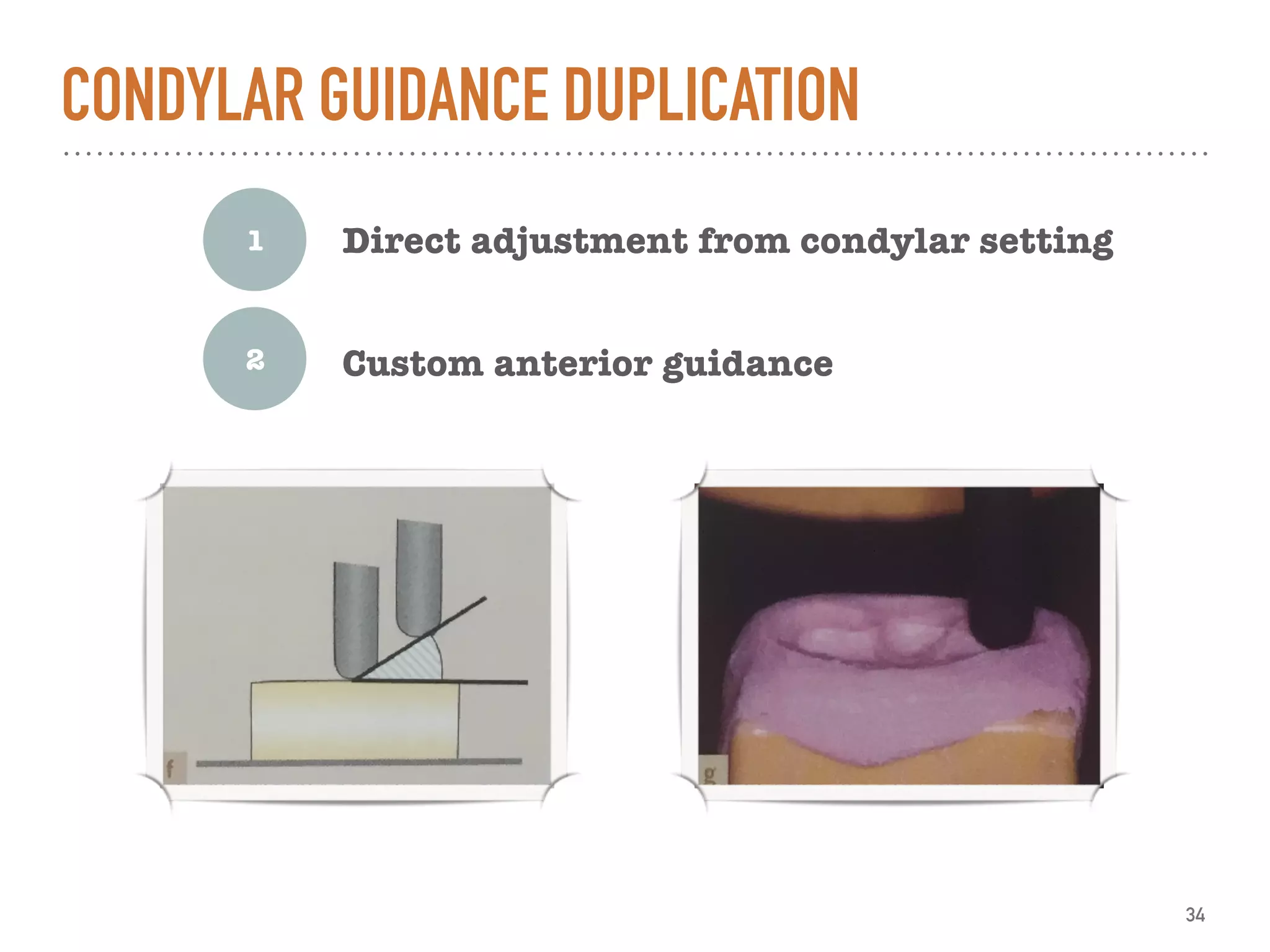 Articulator | PDF