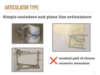 Articulator | PDF