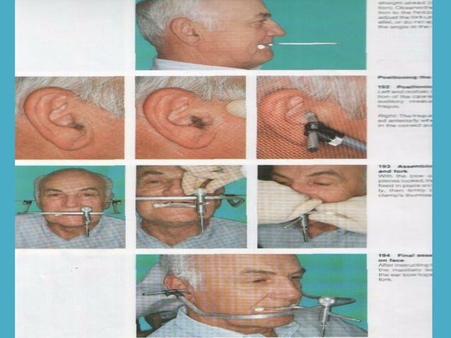 Articulators | PPT | Dental Health | Diseases and Conditions
