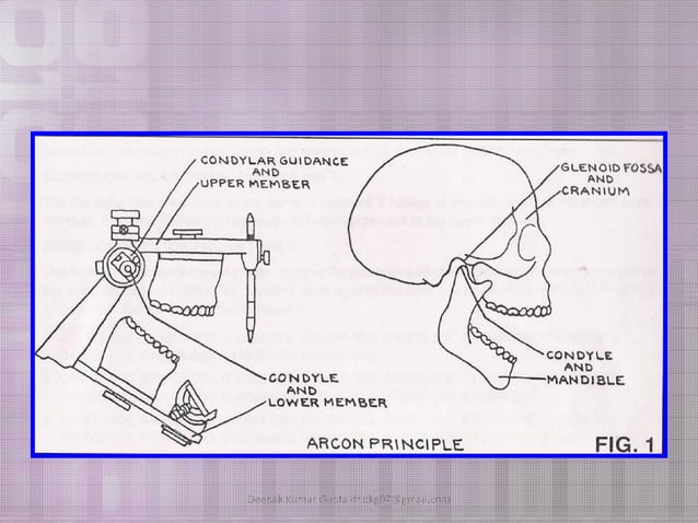 Articulators | PDF | Dental Health | Diseases and Conditions