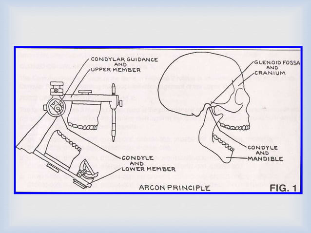 Articulators | PPTX | Dental Health | Diseases and Conditions