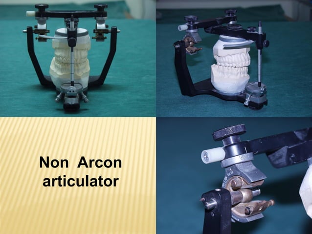 Types of Articulators | PDF | Dental Health | Diseases and Conditions