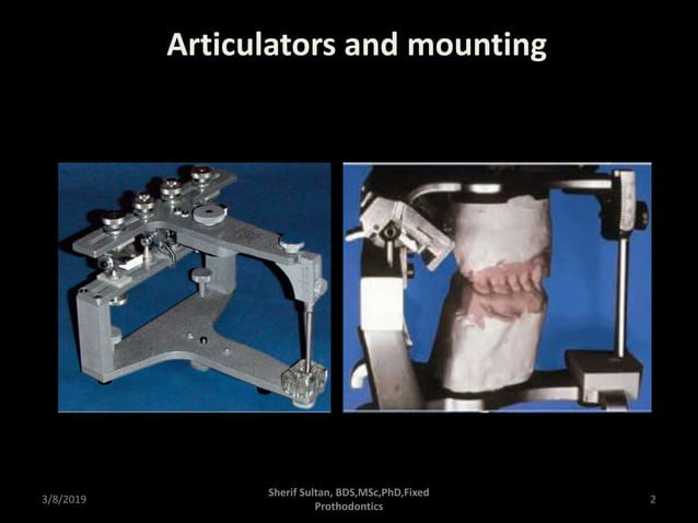 Articulators and mounting | PPTX | Dental Health | Diseases and Conditions