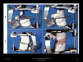 Articulators and mounting | PPTX
