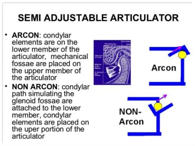 Articulators & face bows