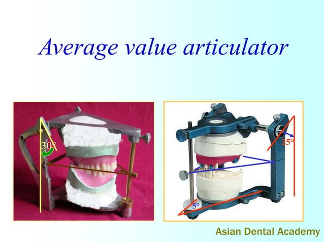 Articulators in complete dentures by dr. anil goud asiandentalacademy | PPT