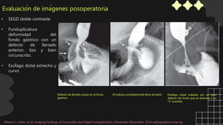 HALLAZGOS FUNDUPLICATURA EXITOSA Y FALLIDA | PPTX