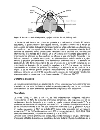 SÍNDROMES DEL PRIMERO Y SEGUNDO ARCOS FARÍNGEOS PARTE 1: EMBRIOLOGÍA Y ...