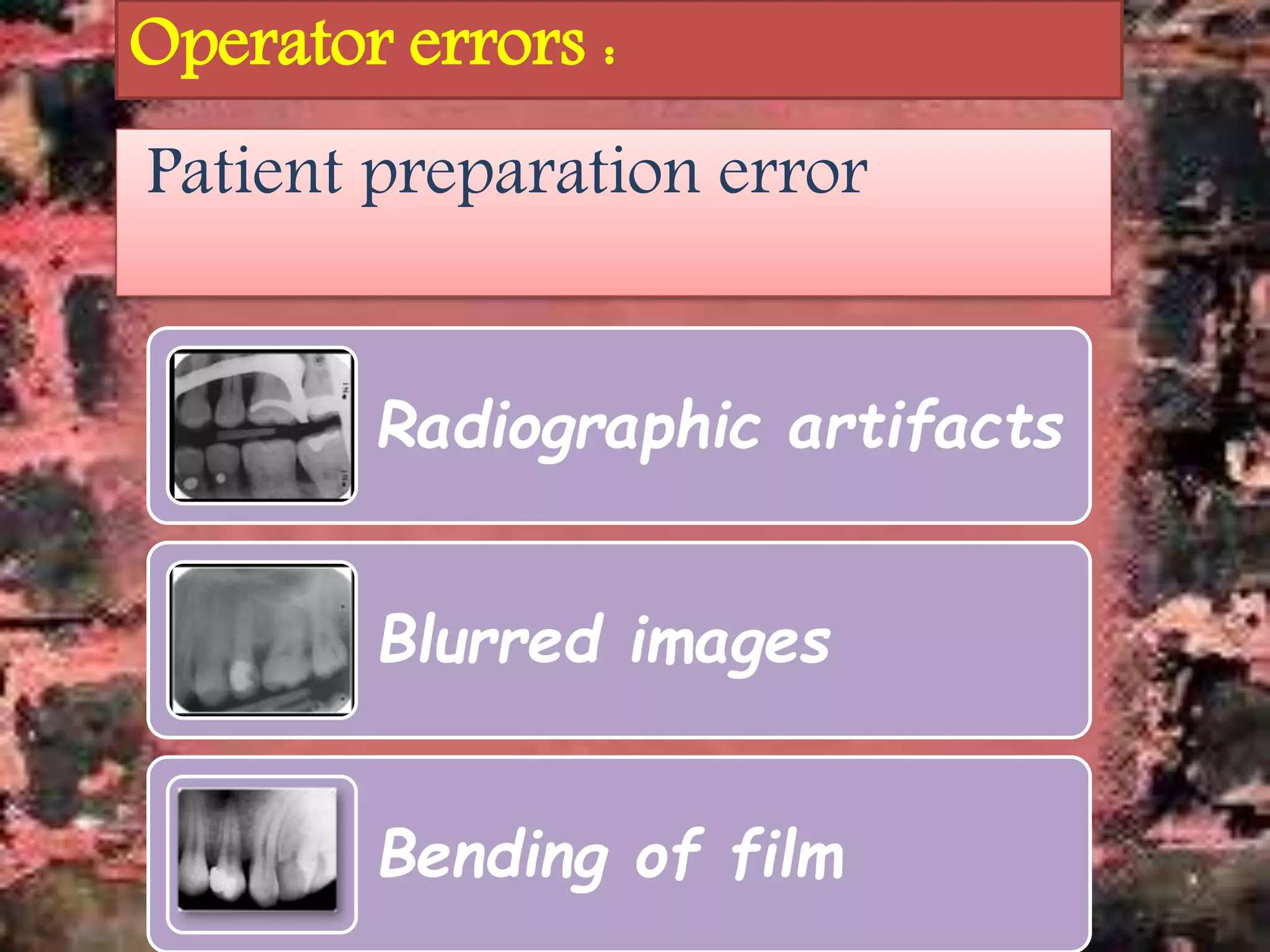 Artifact and errors in intraoral periapical radiograph.ppt