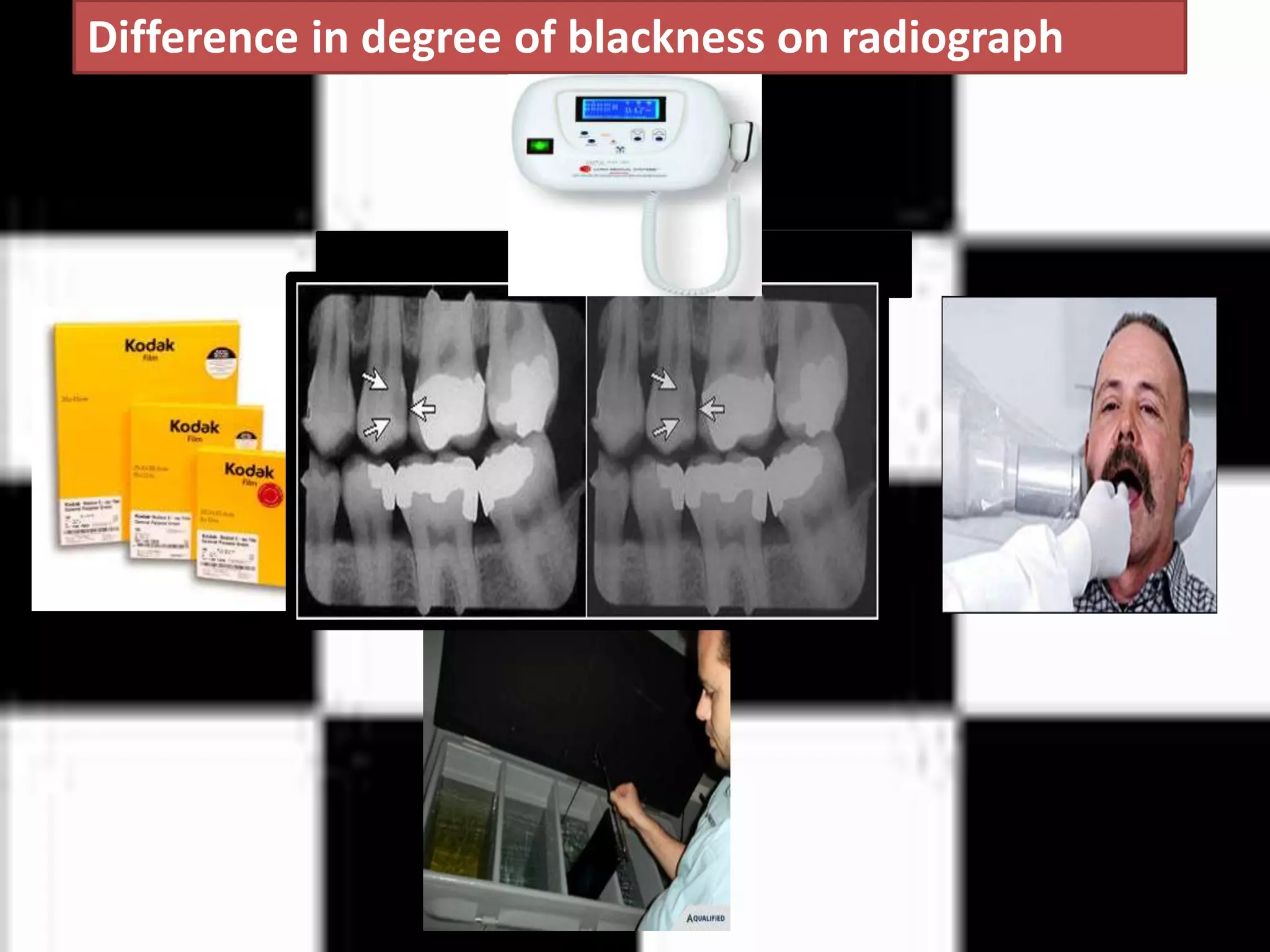 Artifact and errors in intraoral periapical radiograph.ppt