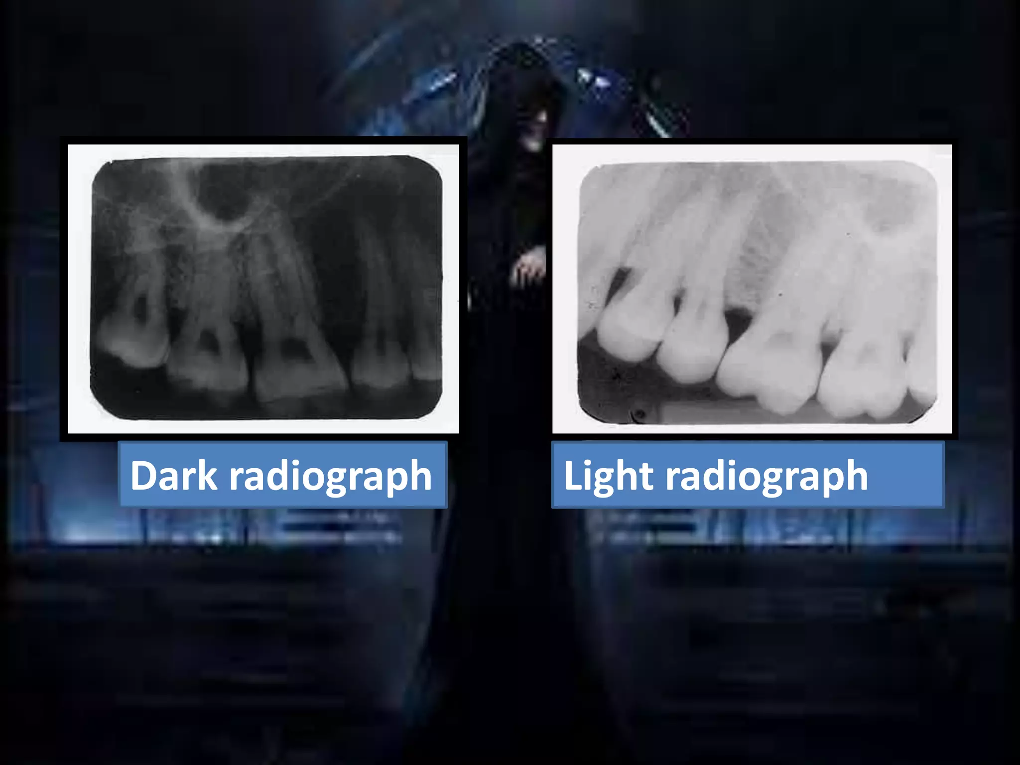 Artifact and errors in intraoral periapical radiograph.ppt
