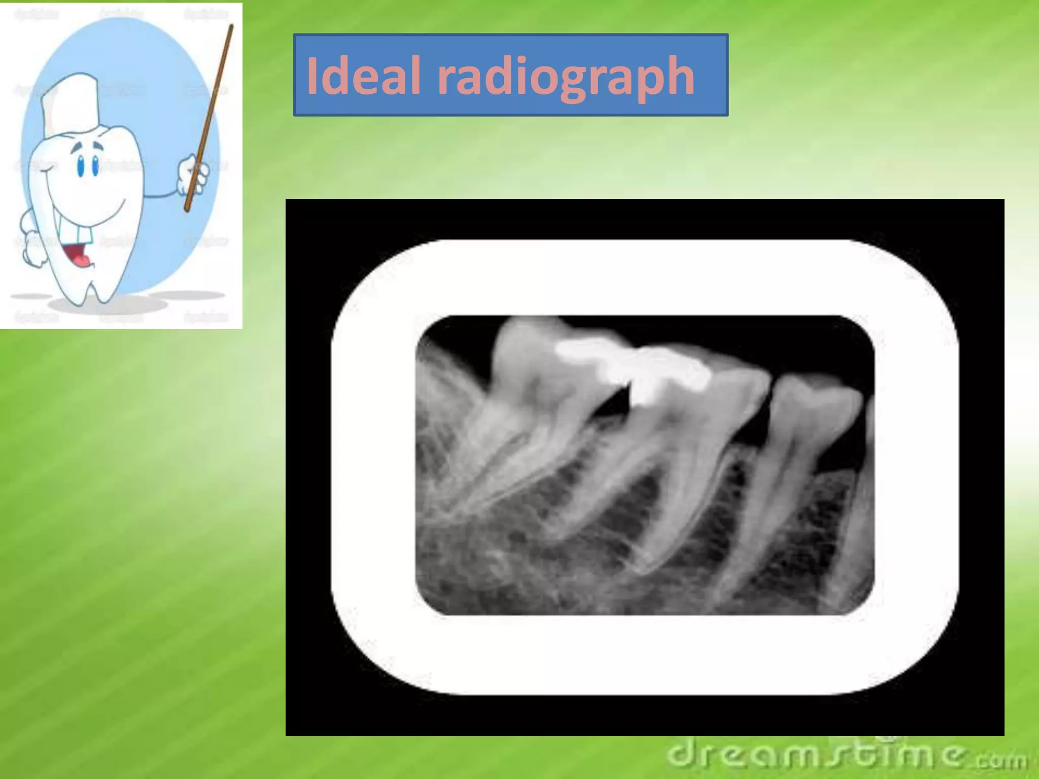 Artifact and errors in intraoral periapical radiograph.ppt