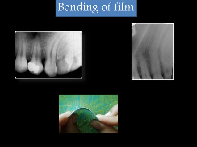 Artifact and errors in intraoral periapical radiograph.ppt ...