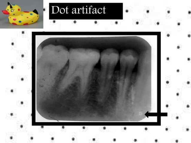 Artifact and errors in intraoral periapical radiograph.ppt ...