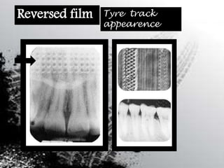 Artifact and errors in intraoral periapical radiograph.ppt