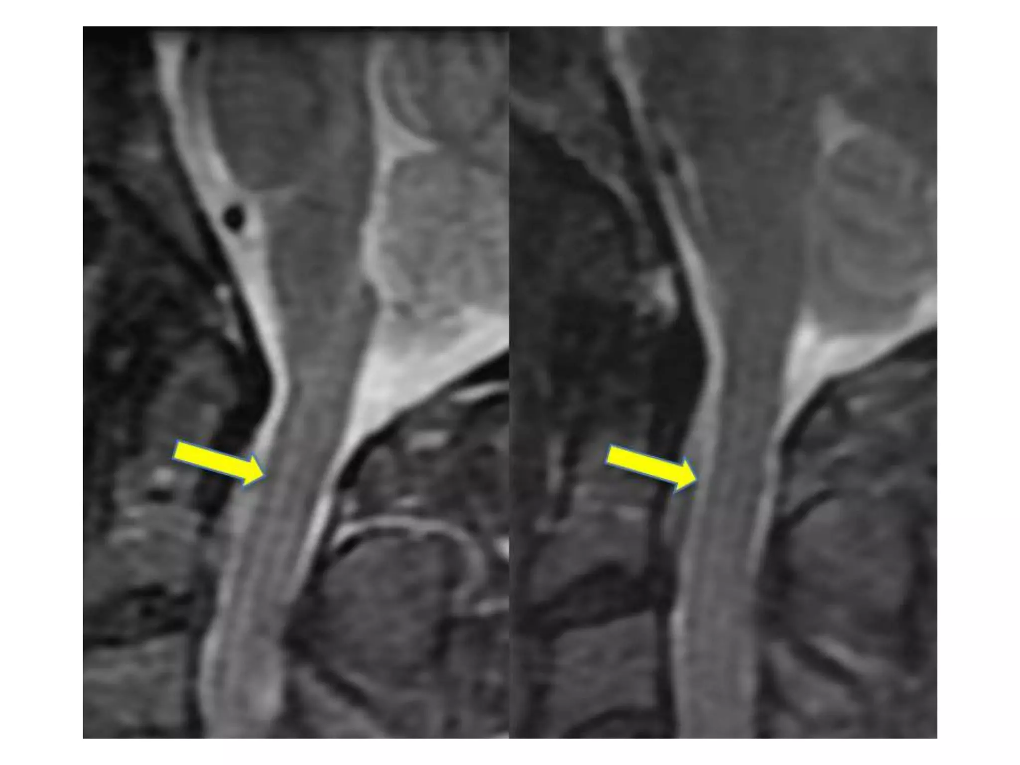 MRI Artifact Radiology | PPTX