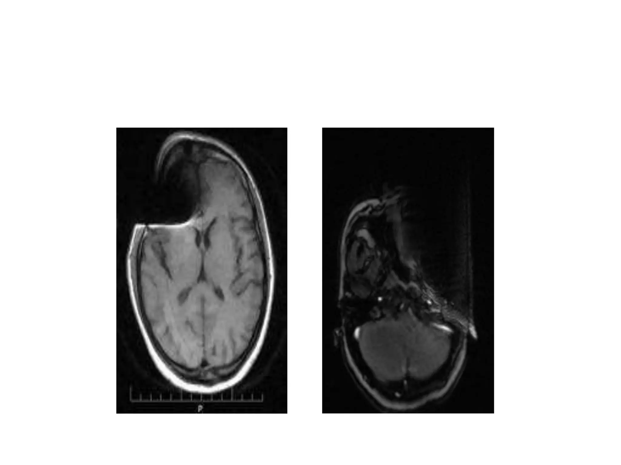 MRI Artifact Radiology | PPTX