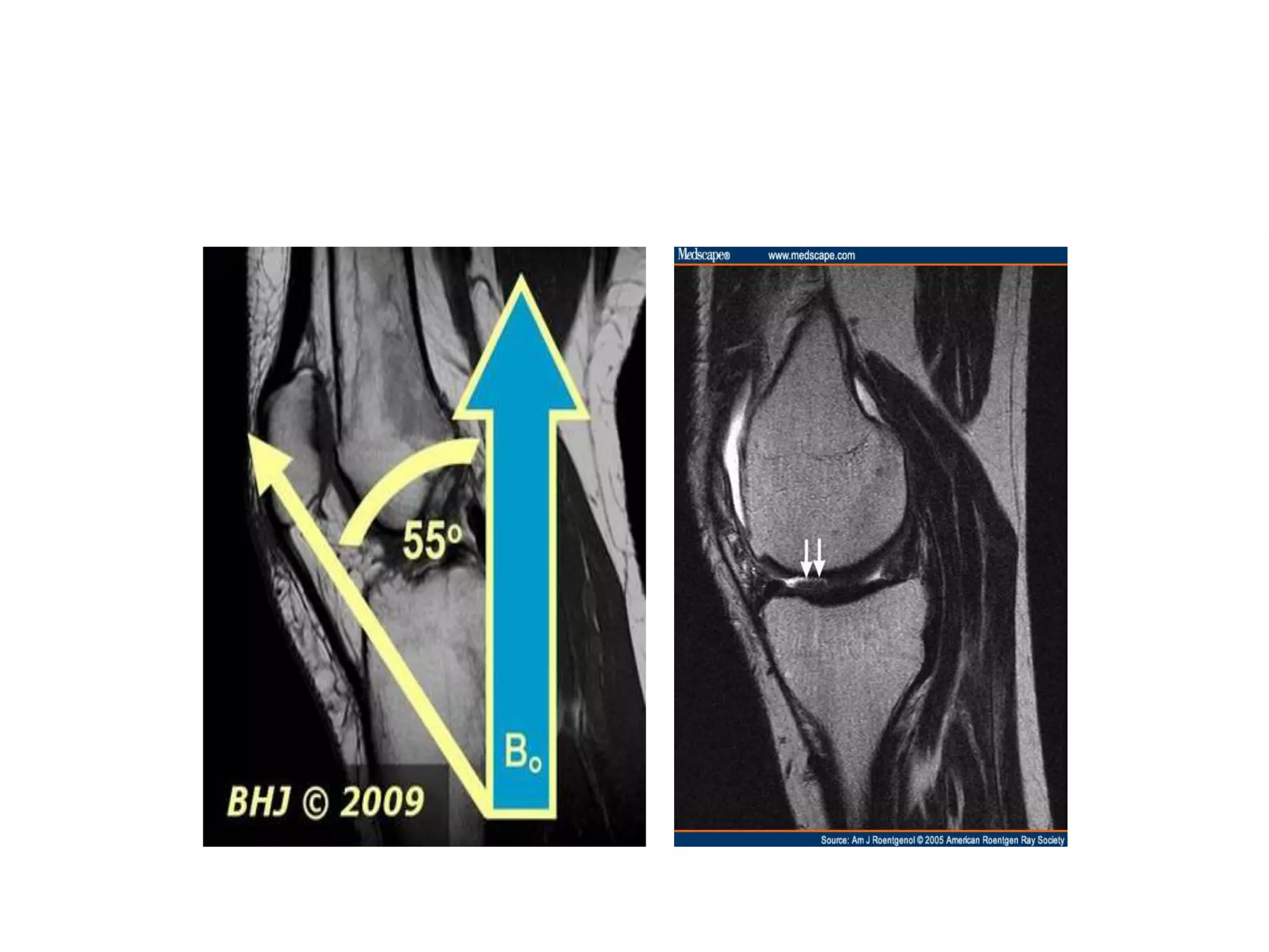 MRI Artifact Radiology | PPTX