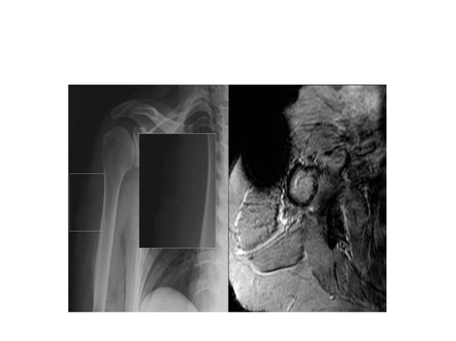 MRI Artifact Radiology | PPTX | Medical Tests | Medical Health
