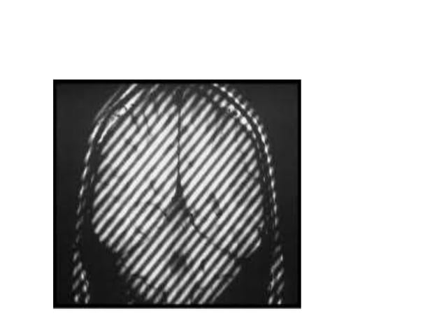 MRI Artifact Radiology | PPTX | Medical Tests | Medical Health