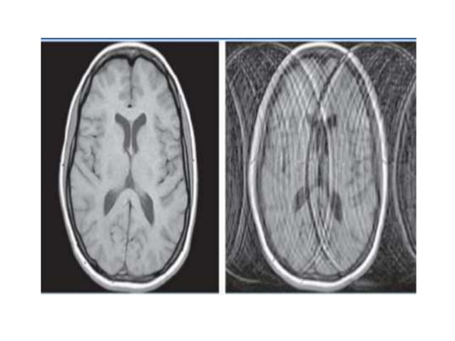 MRI Artifact Radiology | PPTX | Medical Tests | Medical Health