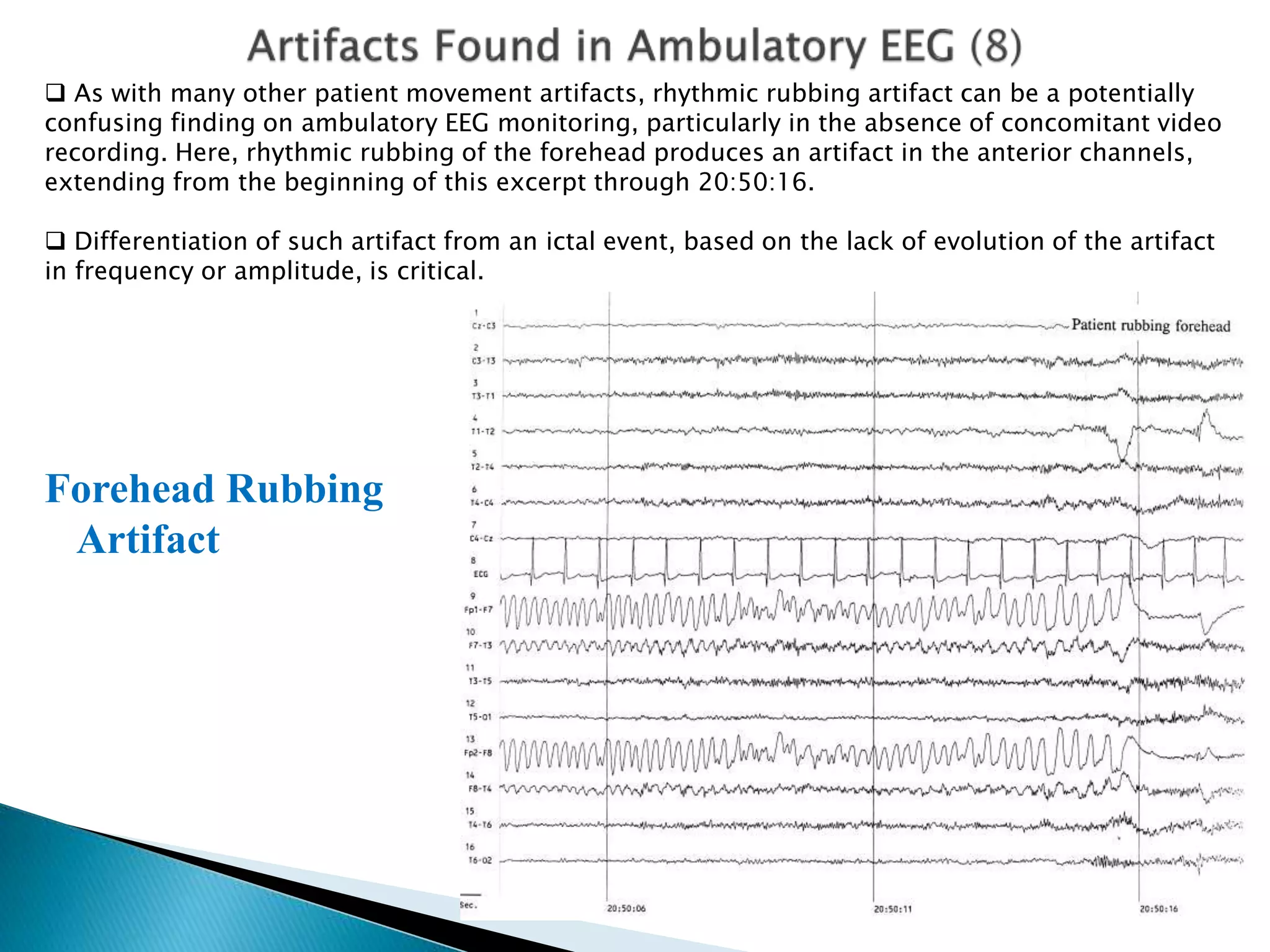 Artifact removal from ambulatory eeg | PPTX
