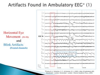Artifact removal from ambulatory eeg | PPTX