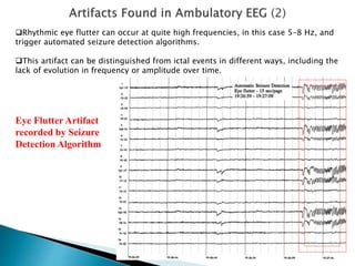 Artifact removal from ambulatory eeg | PPTX