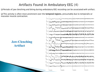 Artifact removal from ambulatory eeg | PPTX
