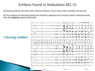 Artifact removal from ambulatory eeg | PPTX