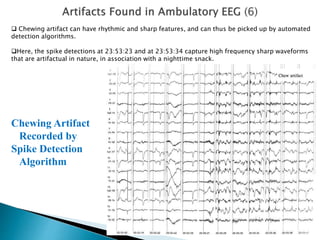 Artifact removal from ambulatory eeg | PPTX