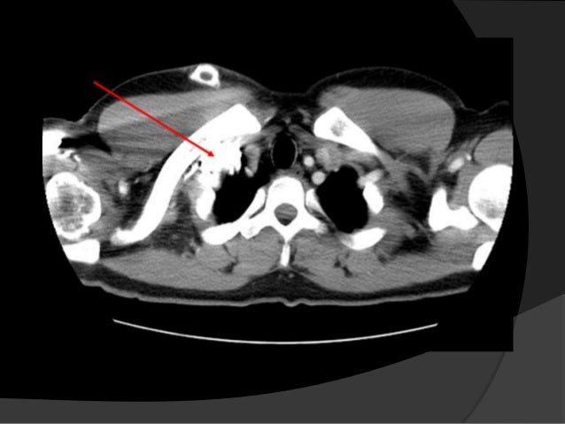 Contrast based artifacts