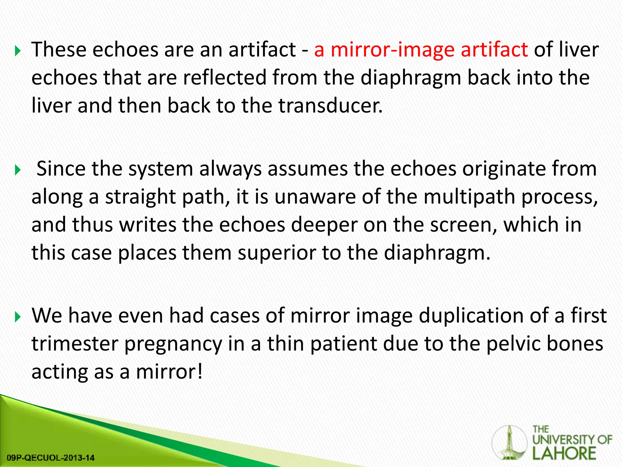 Artifacts in Ultrasound.pptx( by Jalil Hanafi) | PPTX