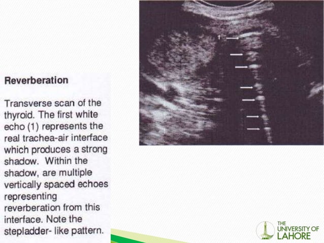Artifacts in Ultrasound.pptx( by Jalil Hanafi) | PPTX | Digital Audio | Computer Software and ...
